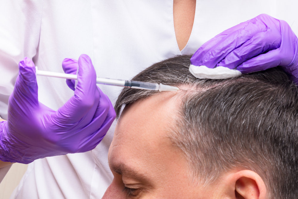 Hair Restoration - Luméra Aesthetics